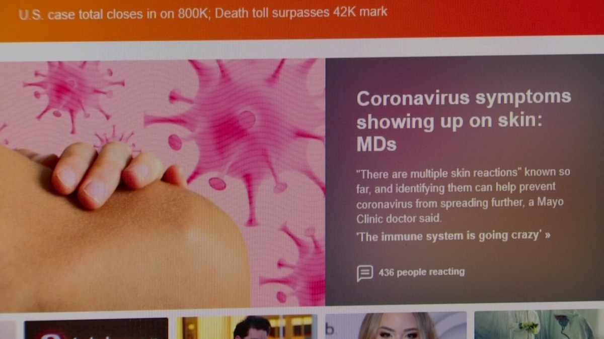 Rashes Might Be New COVID-19 Symptom – NBC 5 Dallas-Fort Worth