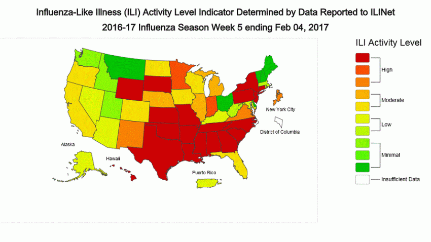 Texas Considered High Flu Activity State – NBC 5 Dallas-Fort Worth