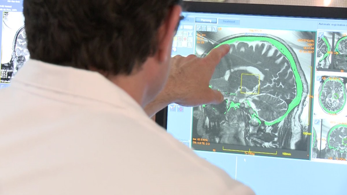 Non-Invasive Procedure Helps Stop Tremors – NBC 5 Dallas-Fort Worth