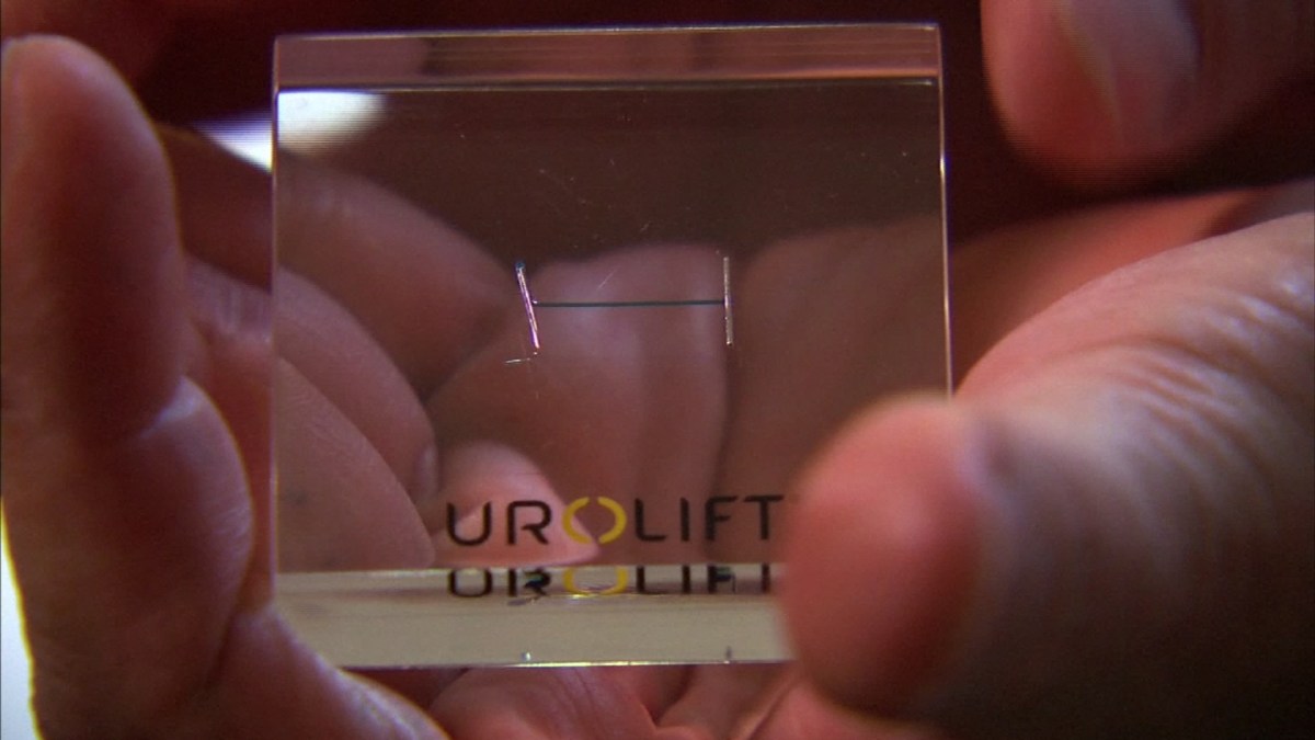 New Procedure Offers Help for Enlarged Prostates – NBC 5 Dallas-Fort Worth