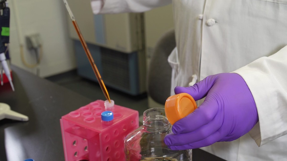 Spray-On Skin Better Than Grafts for Some Burns – NBC 5 Dallas-Fort Worth