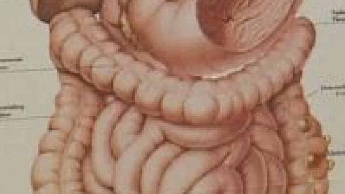 FDA approves blood test to screen for colon cancer – NBC 5 Dallas-Fort ...