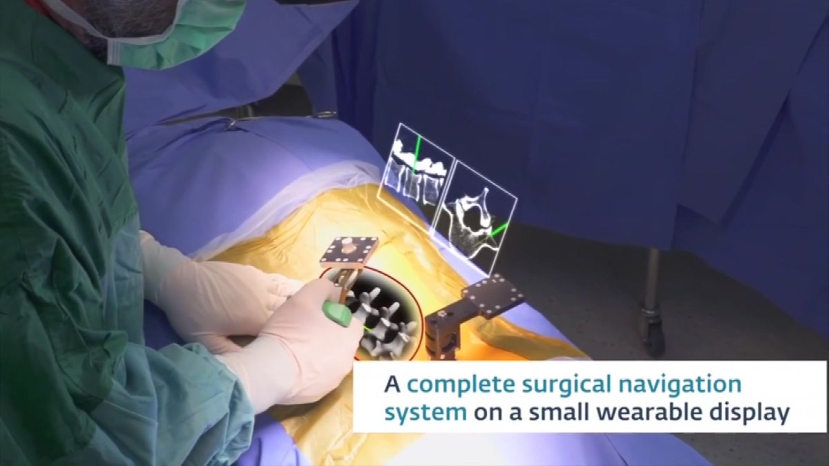 Surgeons Use Augmented Reality In The Operating Room – NBC 5 Dallas ...