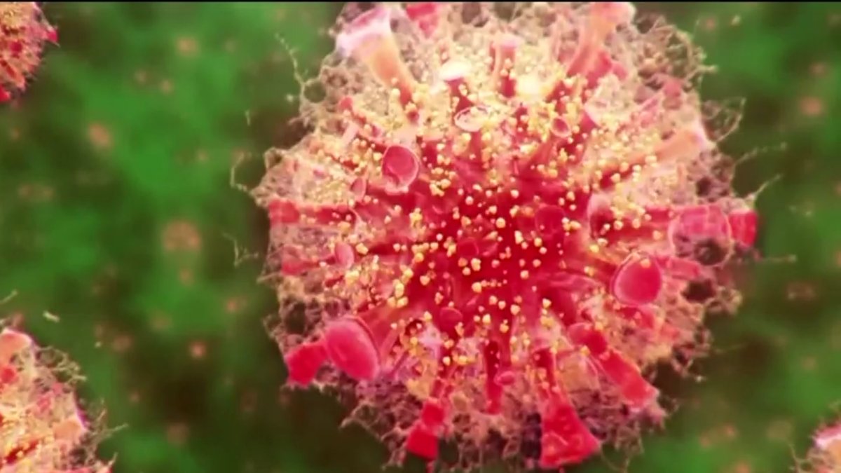 What to Know About the COVID-19 Delta Variant – NBC 5 Dallas-Fort Worth
