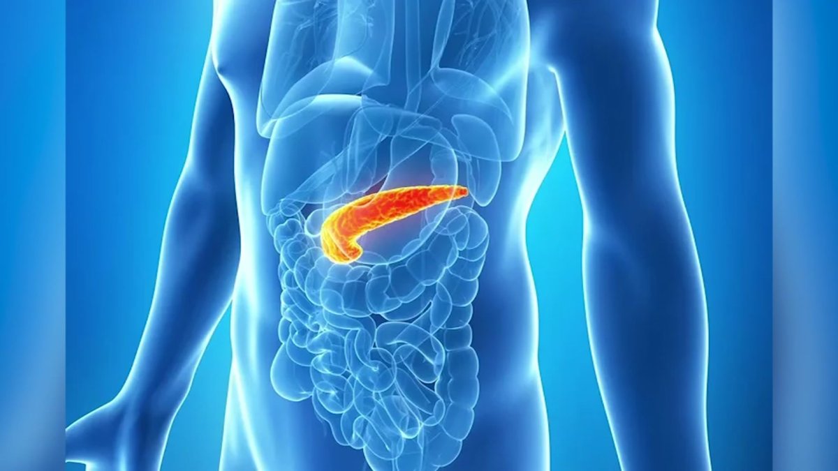 Treatment for Hereditary Pancreatitis Allows Children to Live Pain-Free ...