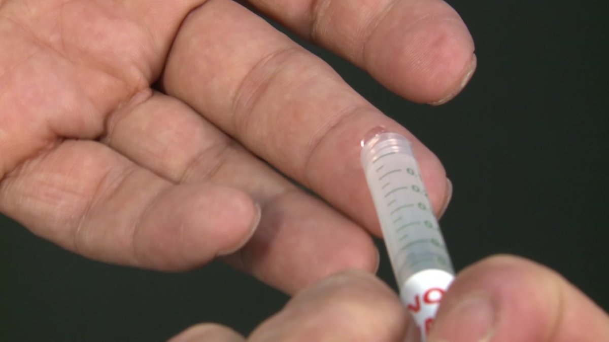 New Procedure Used To Treat Urinary Incontinence In Women Nbc 5