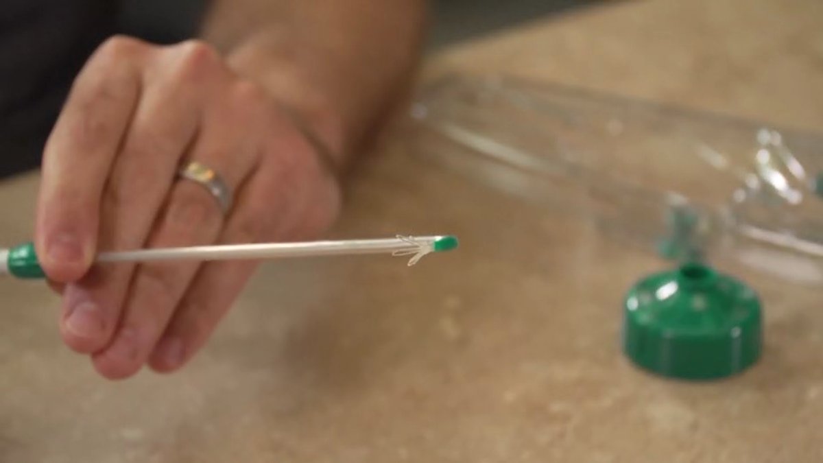 PROPEL Stent To Clear Chronic Sinusitis – NBC 5 Dallas-Fort Worth