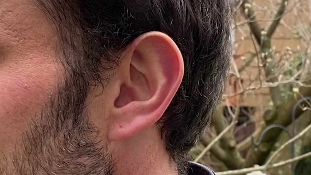 The Eww About Earwax Removal Kits – NBC 5 Dallas-Fort Worth