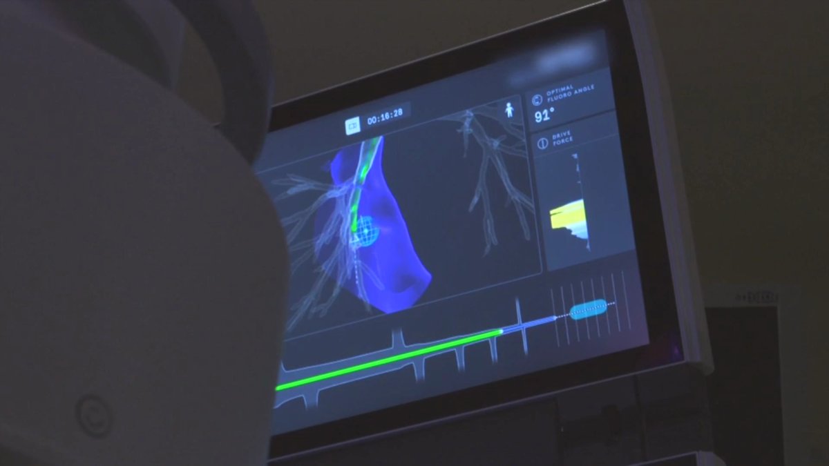 North Texas Woman Beats Cancer on Day of Diagnosis – NBC 5 Dallas-Fort ...