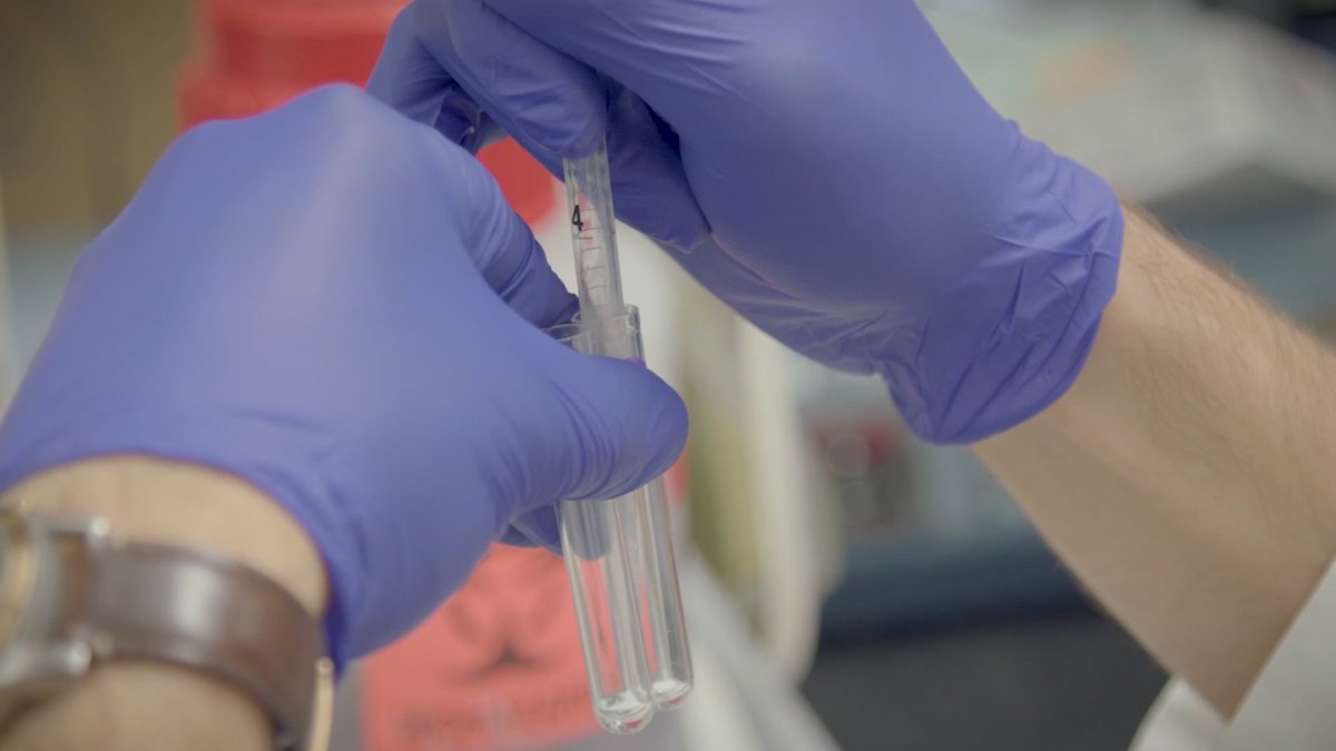 CAR T Cell Therapy Gives Hope to Non-Hodgkin Lymphoma Patients – NBC 5 ...