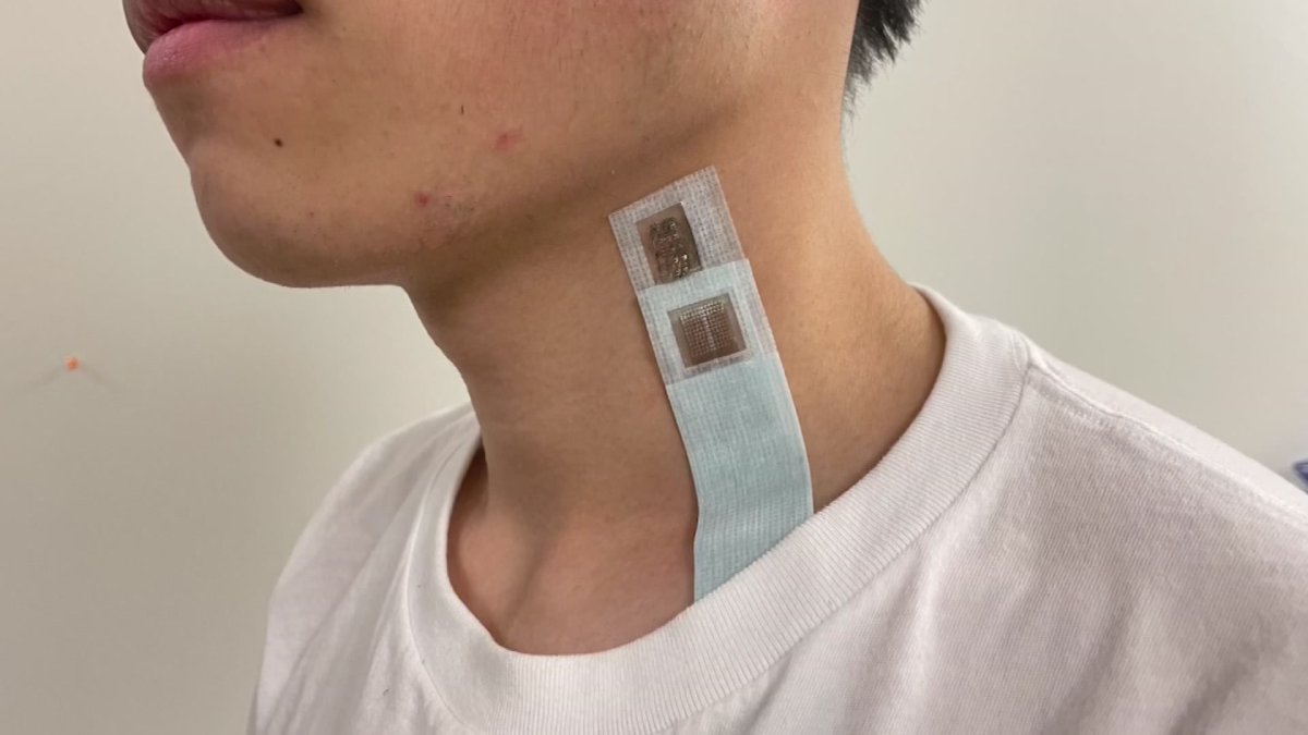Could a Skin Patch That Predicts Heart Attacks and Strokes Be Medicine ...