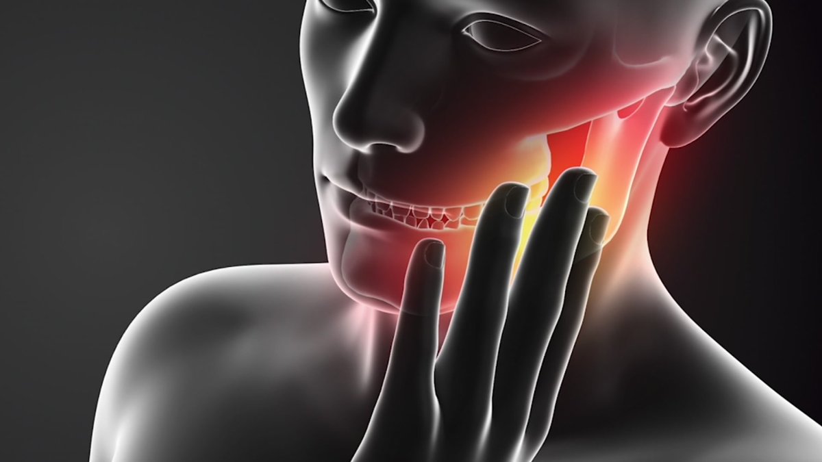 Here’s What Causes You to Grind Teeth – NBC 5 Dallas-Fort Worth