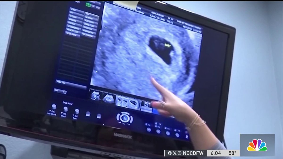 Latest details on Dallas woman who sought abortion in Texas – NBC 5 ...