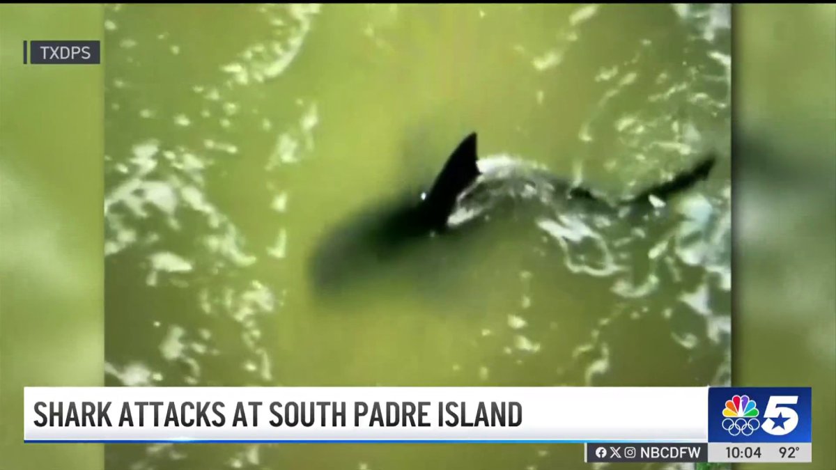Shark attacks at South Padre Island – NBC 5 Dallas-Fort Worth