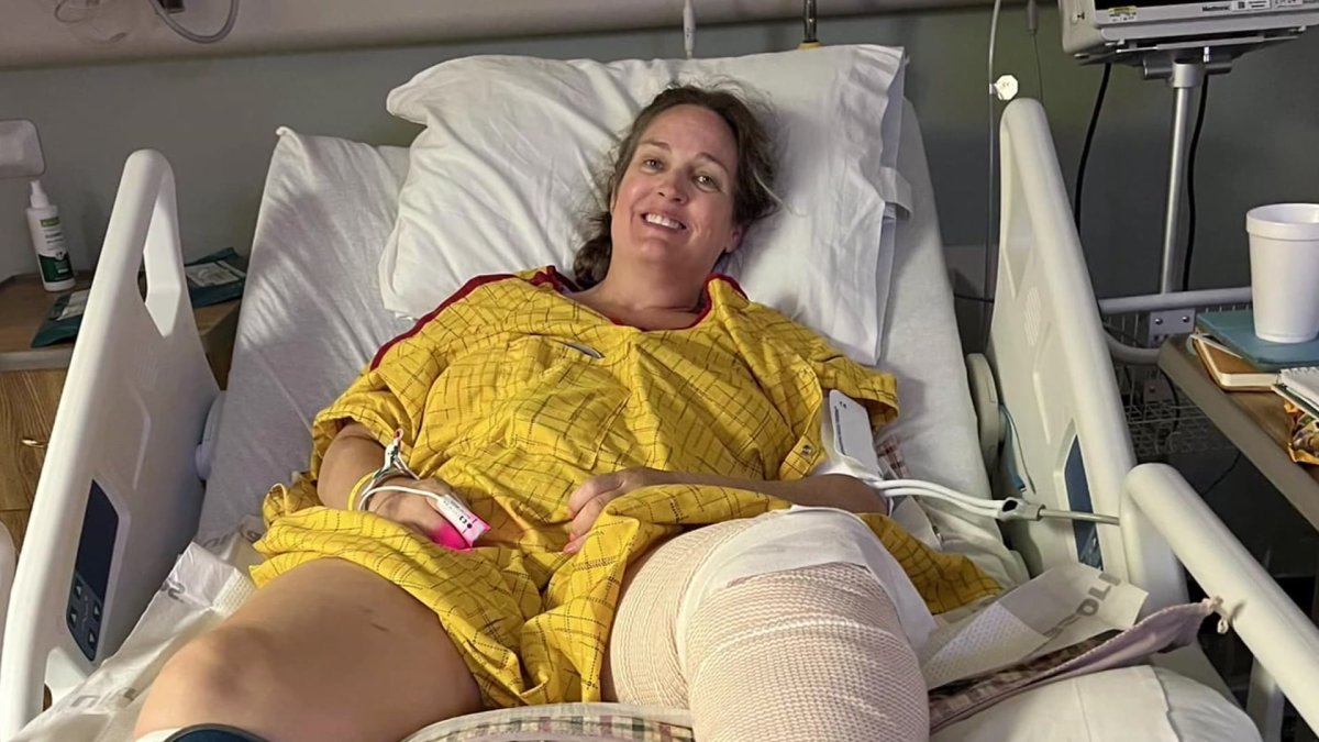 Woman relives South Padre Island shark attack – NBC 5 Dallas-Fort Worth