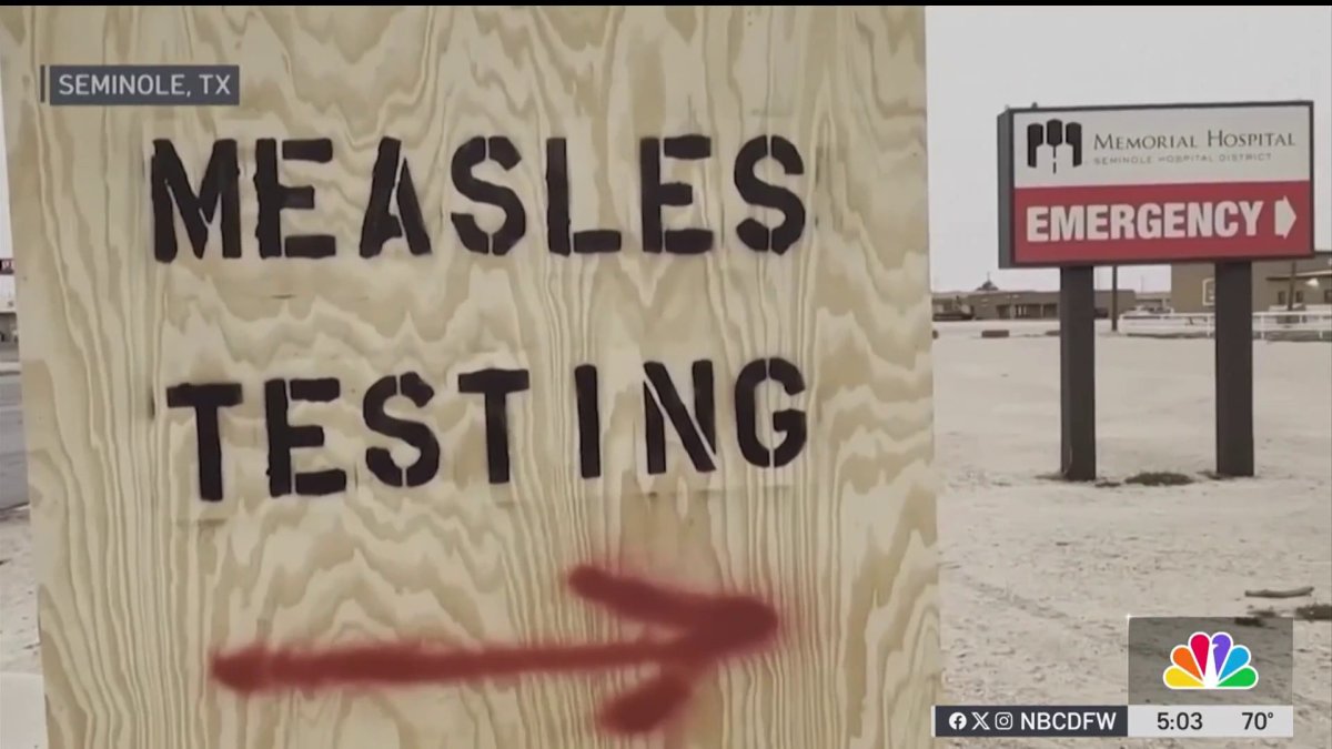 Measles in Texas may last for months – NBC 5 Dallas-Fort Worth