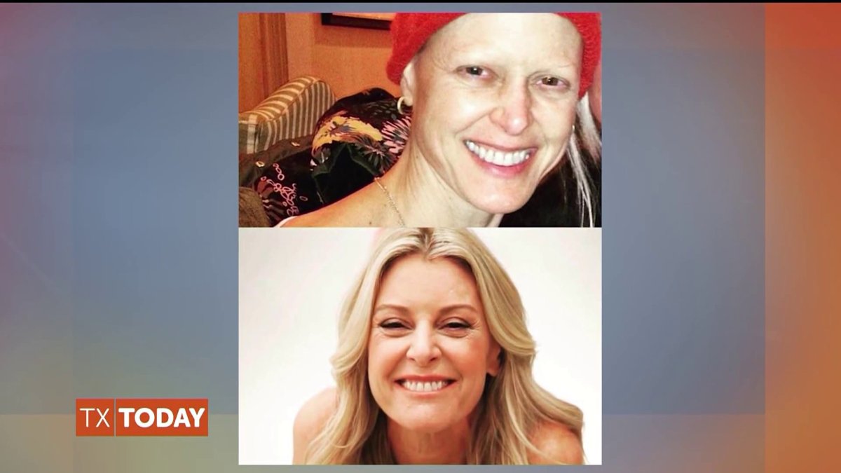 Voice of hope, courage, and transformation – NBC 5 Dallas-Fort Worth